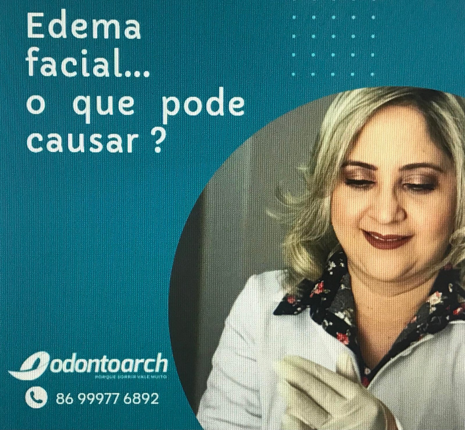 O que pode causar edema na face ? – OdontoArch